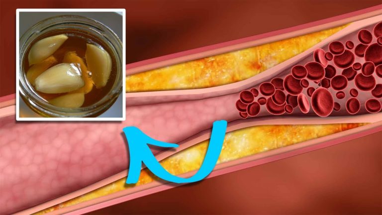 Triglicéridos - Laboratorio Análisis Clínicos - Citolab